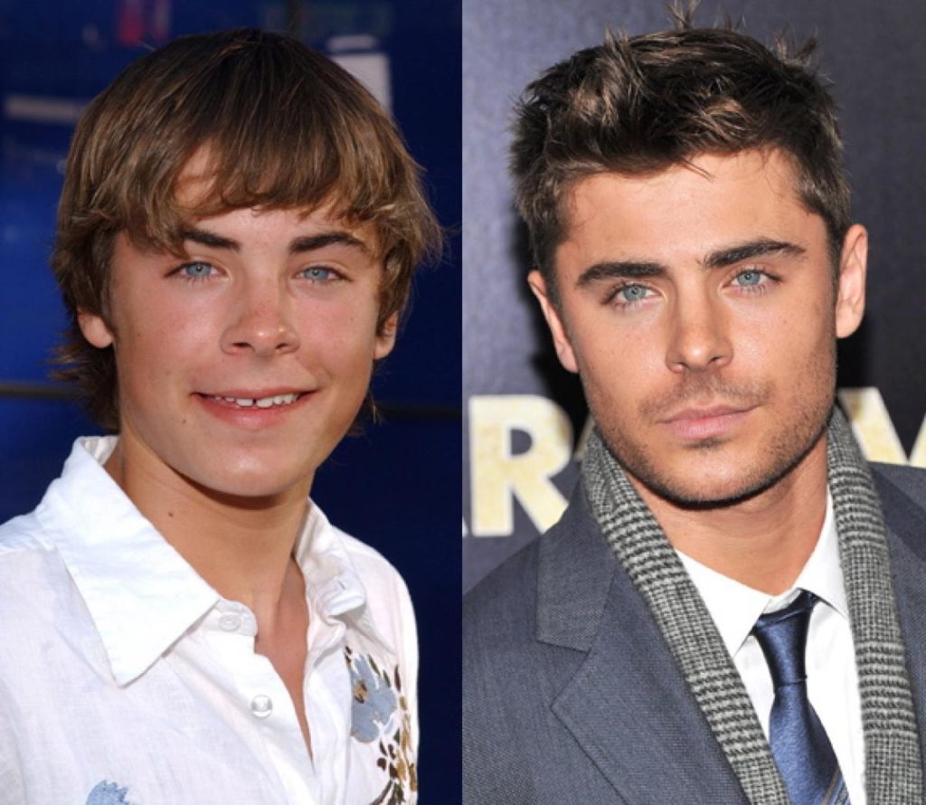 Did Zac Efron Get Plastic Surgery? Here’s What We Know